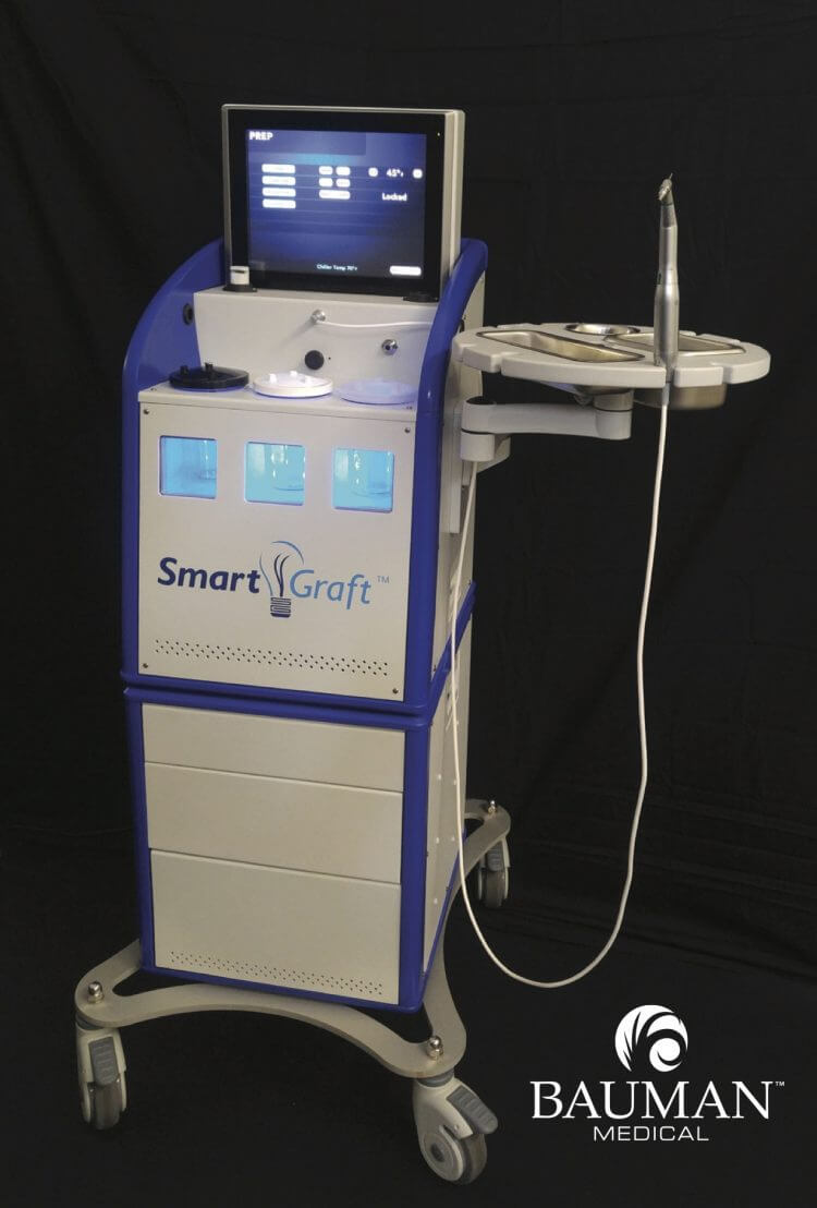 What Is Smartgraft Fue Hair Transplant · Bauman Medical