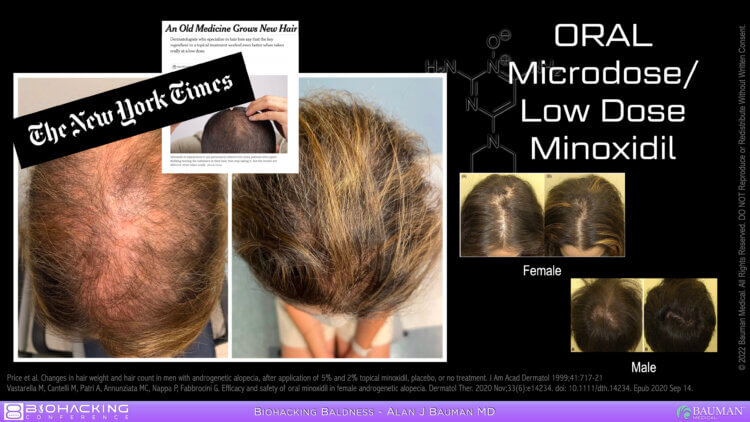 Low Dose Oral Minoxidil For Hair Regrowth · Bauman Medical